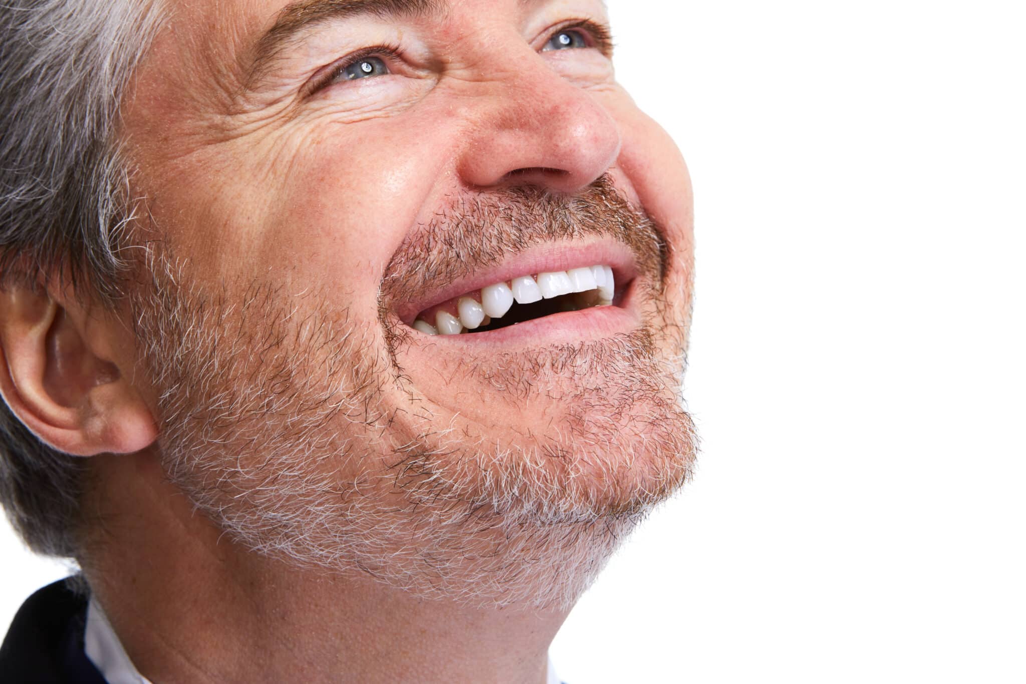 Healing After Bone Grafting | Dentist in Melville, NY